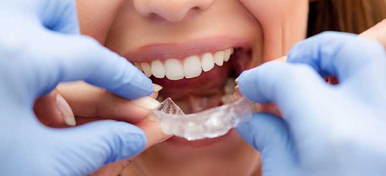 Digital orthodontics Course – The Jordanian Orthodontic Society